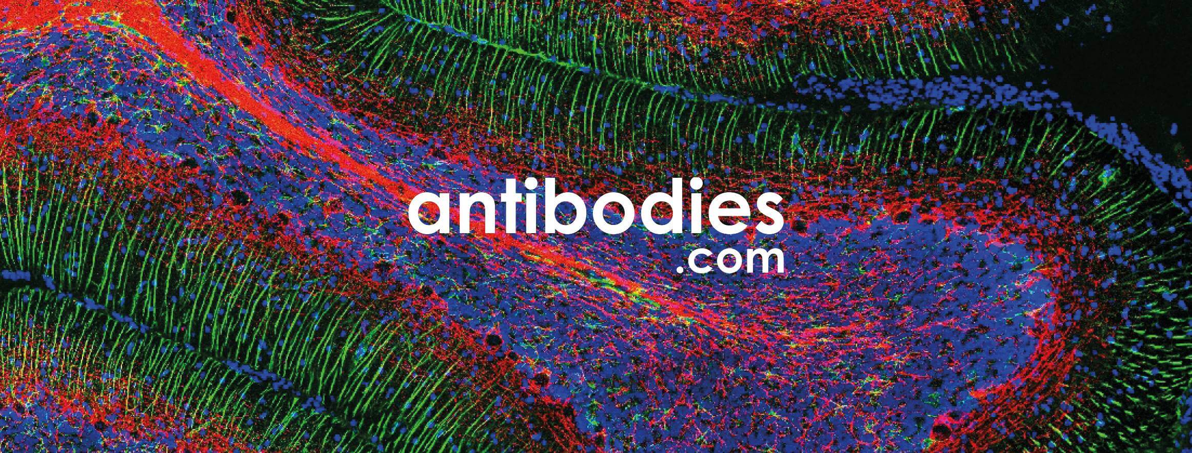 Antibodies.com Raises £400,000 Pre-Seed - TechRound